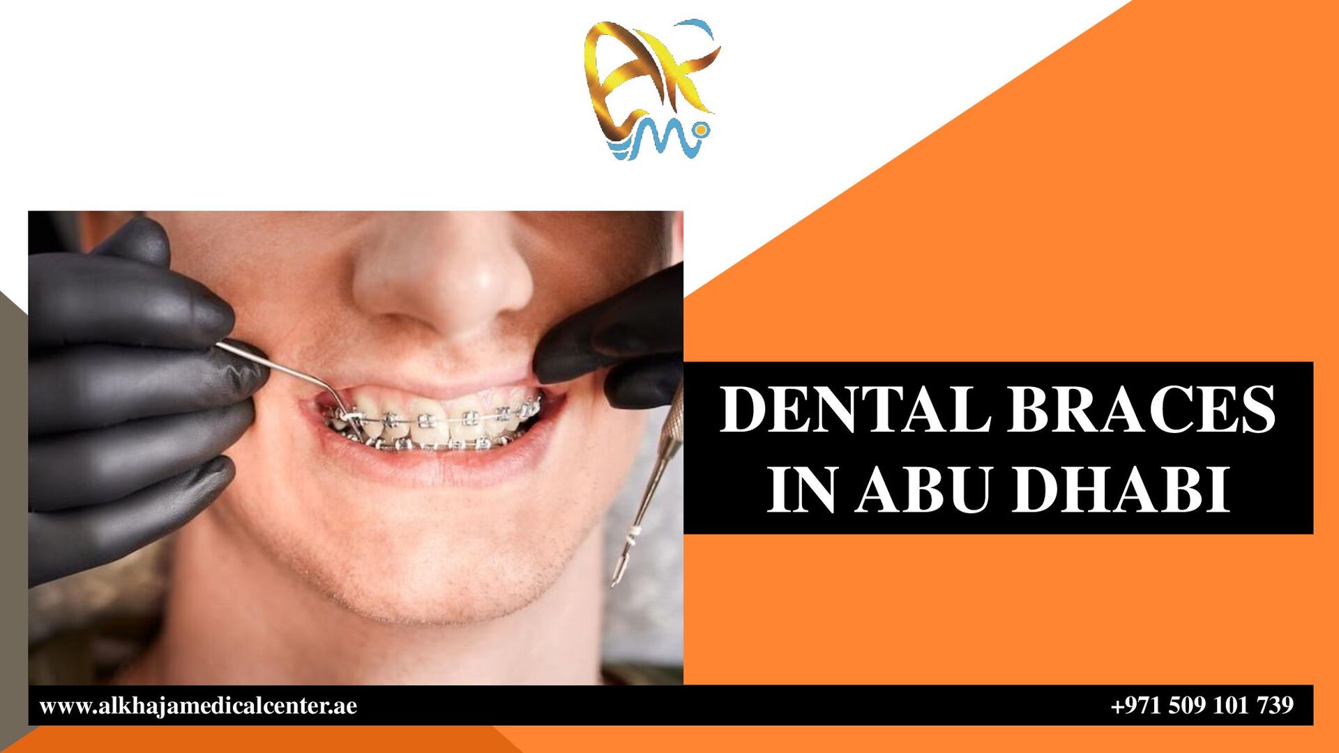 Dental Braces In Abu Dhabi Pdf Speaker Deck