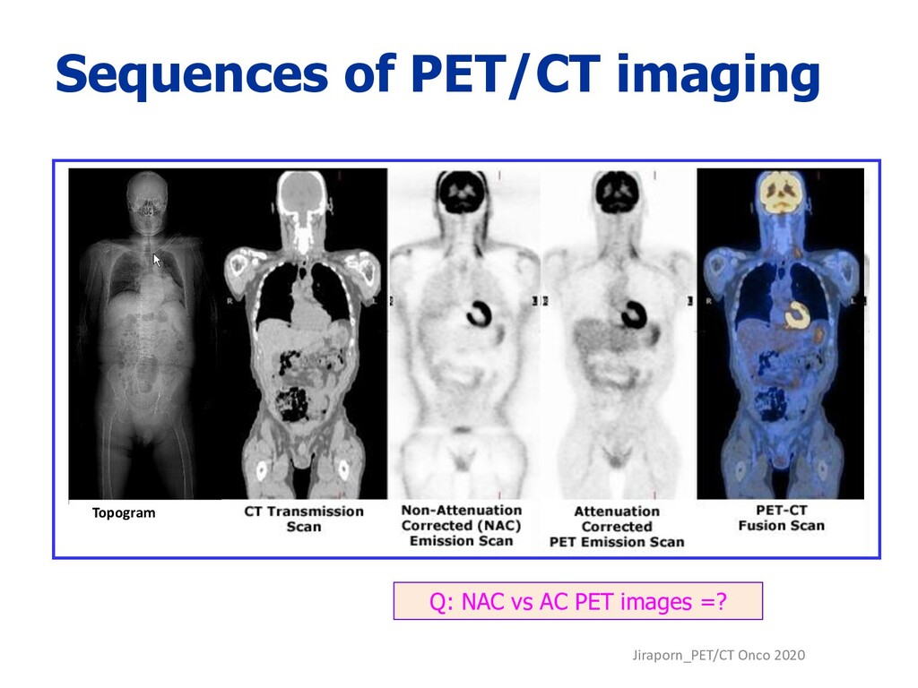 FDG PET-CT in Oncology part 2 - Speaker Deck