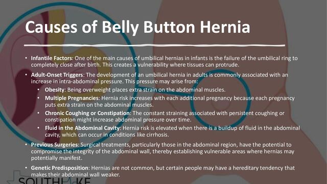 Belly Button Hernia A Quick Guide Speaker Deck