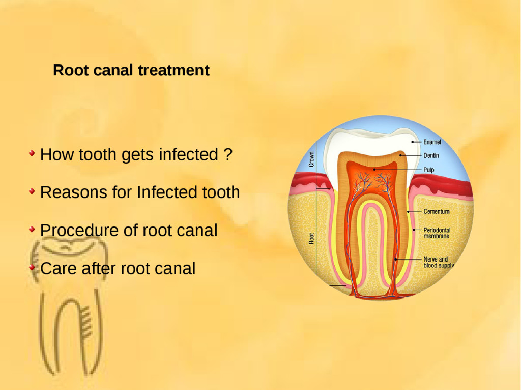 Root canal treatment- An effective way to deal with infected teeth ...